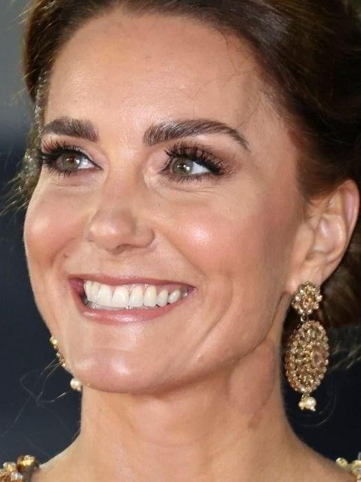 😳«The 42-year-old Princess of Wales worried fans with her appearance ...